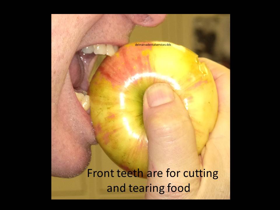 Missing Tooth Replacement Salisbury MD